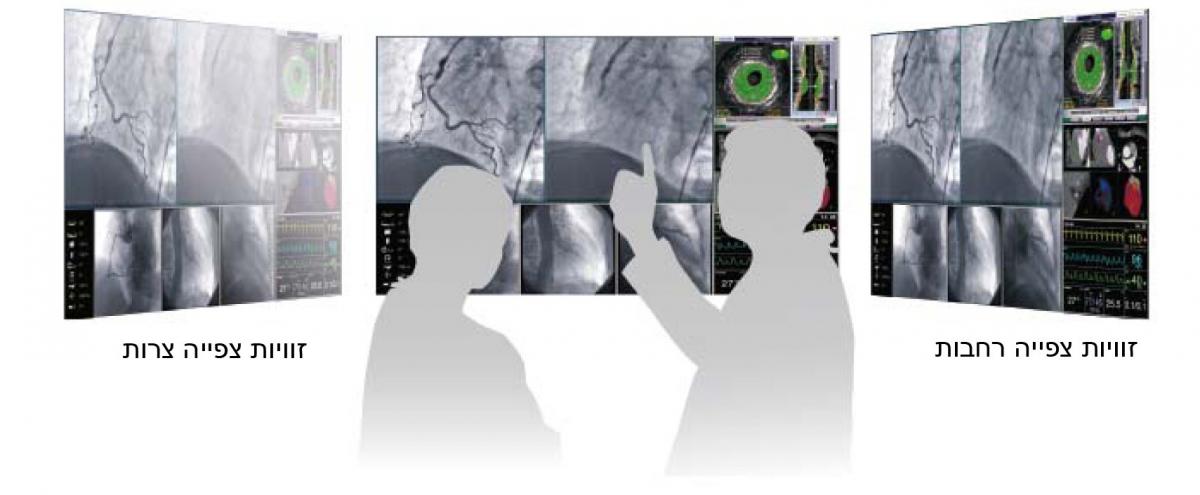 RadiForce LS580W - EIZO