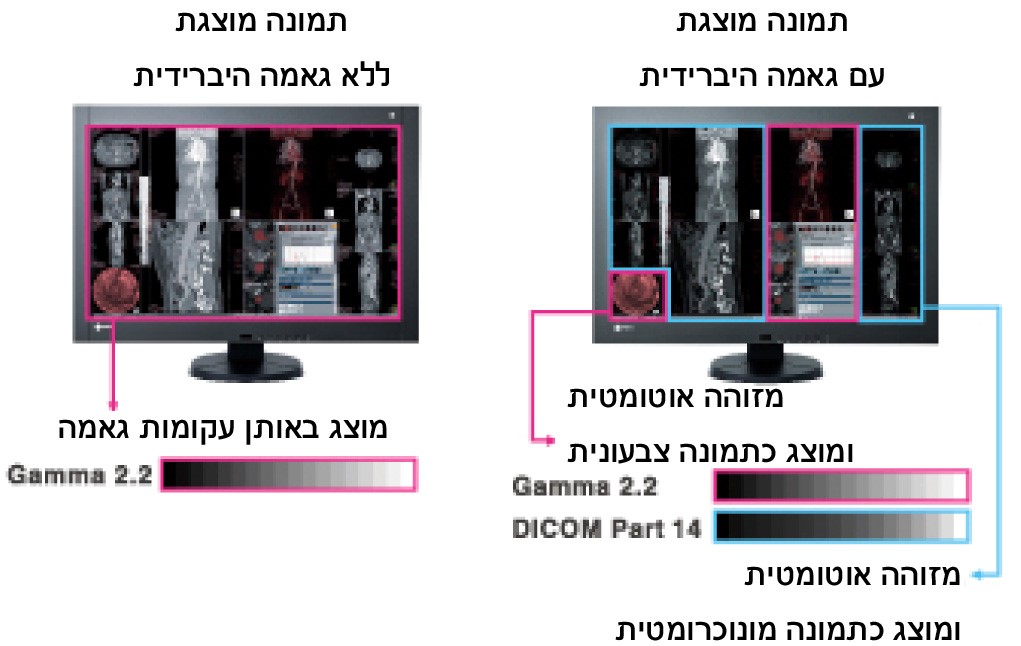 RadiForce RX440 - EIZO